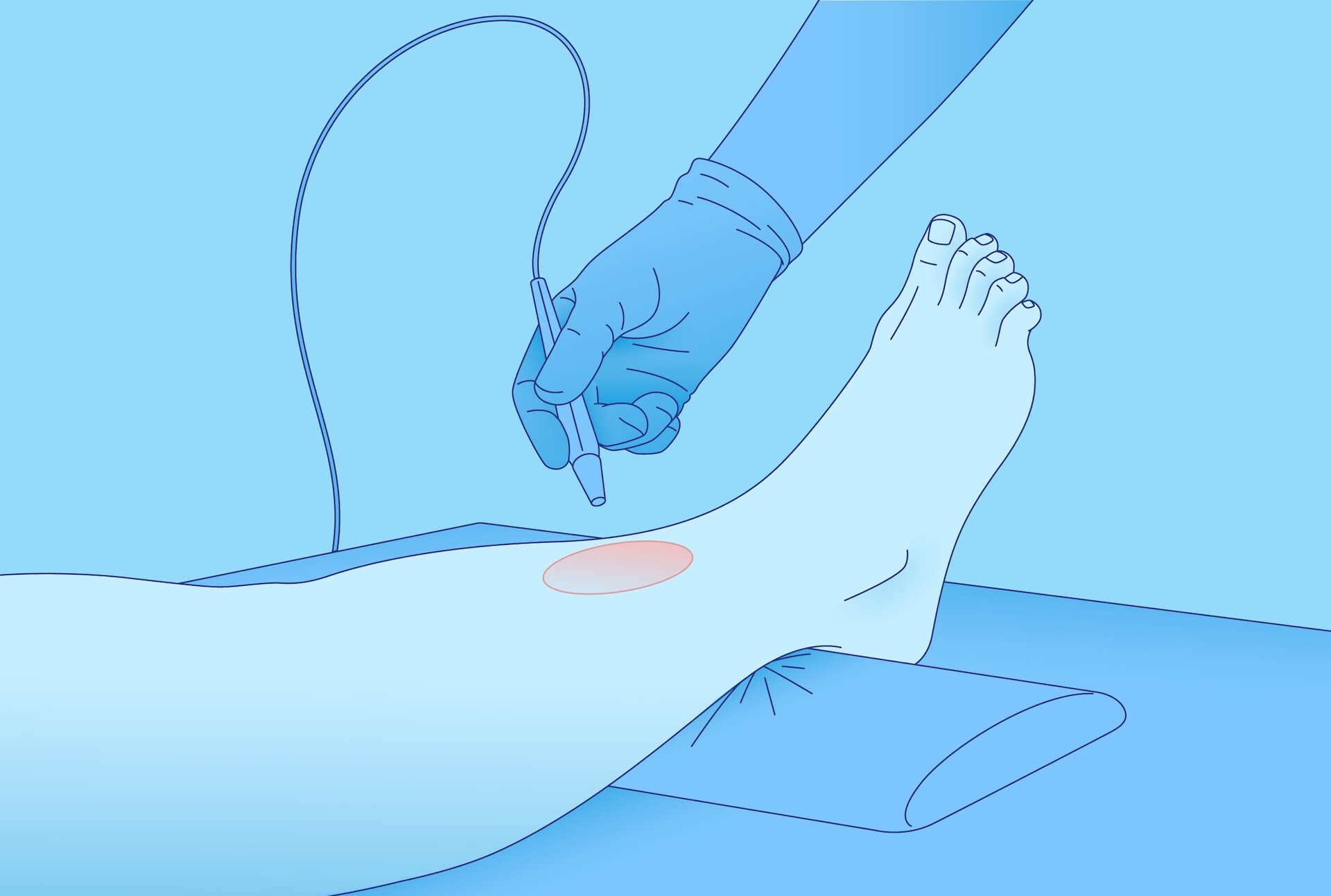 Complex Lower Extremity Wound cases - Medaxis